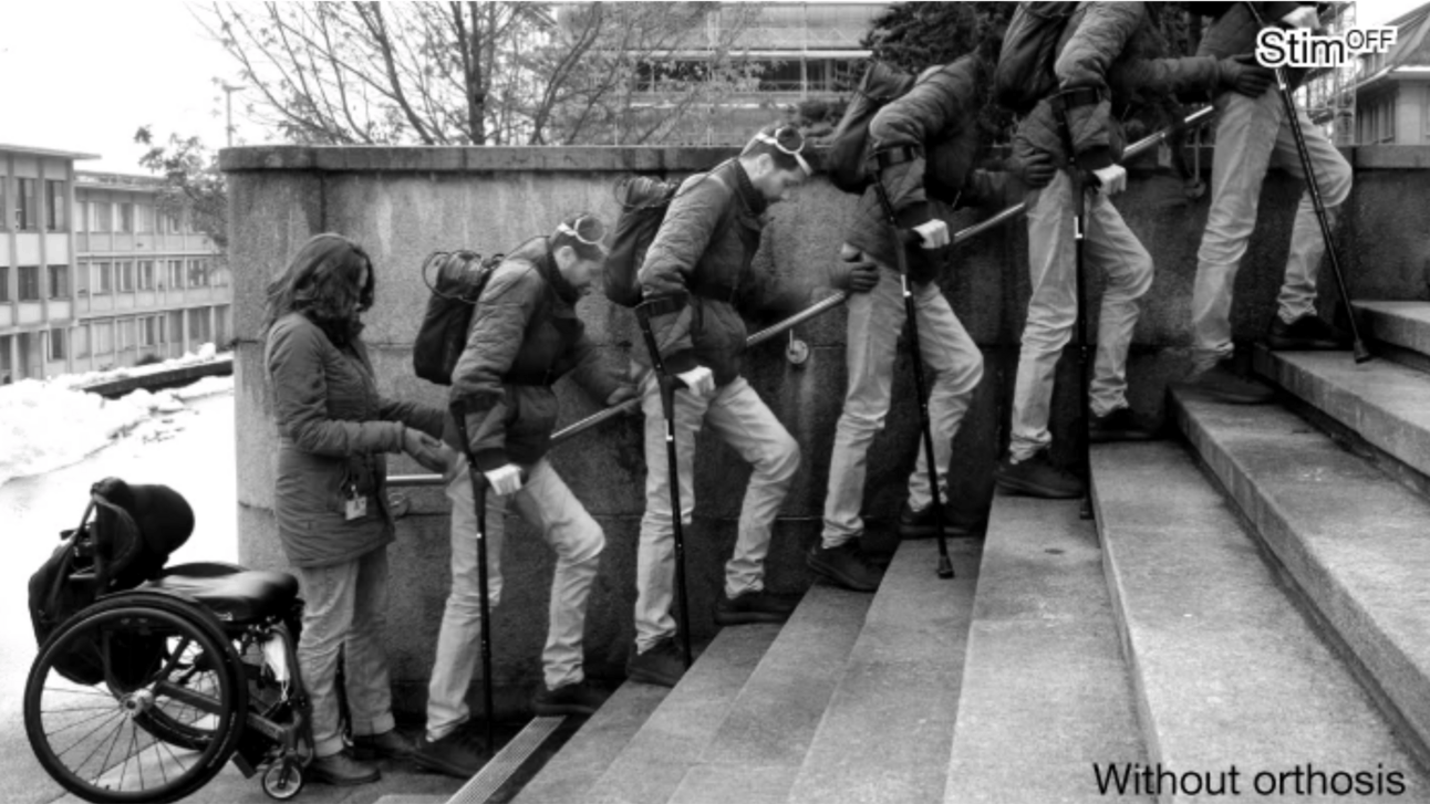 A digital bridge lets a paralyzed man walk