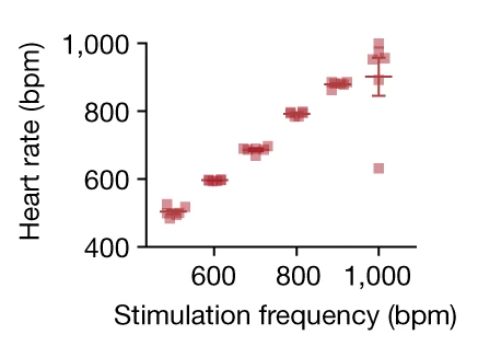 How an anxious heart controls the brain